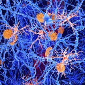 Neurology | Neuron Medical Corporation | Thousand Oaks, CA